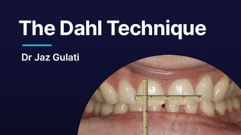 Master Dentist Jaz Gulati