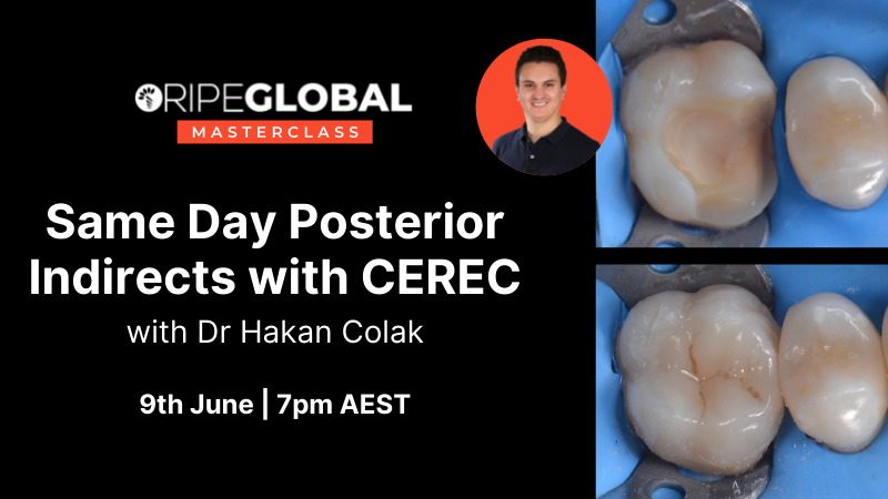 Triangular Fossa Teeth