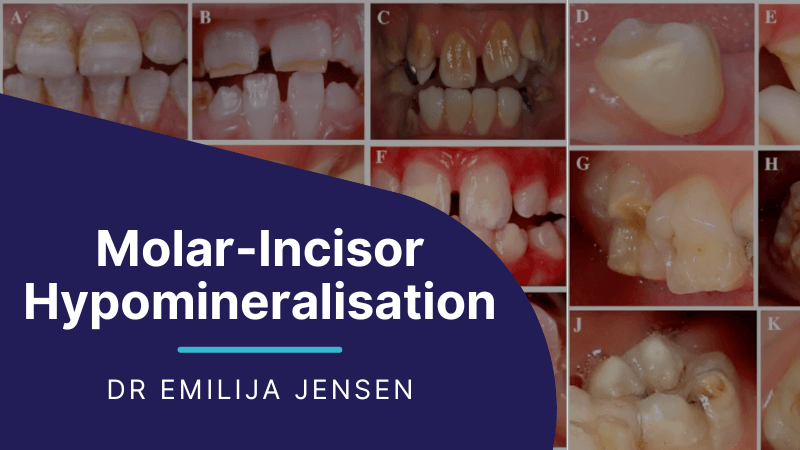 Molar incisor hypomineralisation