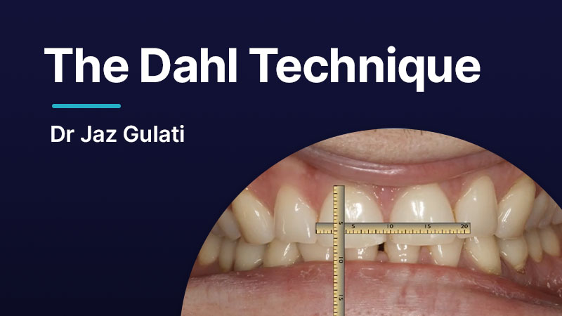 Introduction to the Dahl Technique - Localised Anterior Toothwear